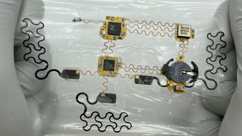 Kalp hastalıkları için giyilebilir bir sensör geliştirildi - LOG